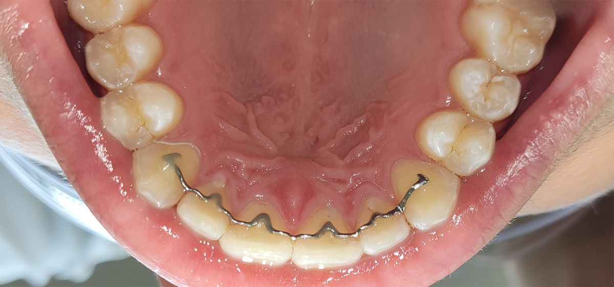 Praxis mit Zahnarzt Zahnprothetik Zahntechnik 8050 Zürich